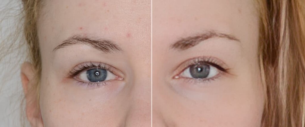 Face enhancement effecting eyes - General - Topaz Community